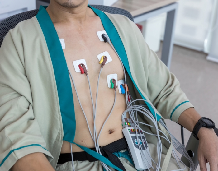 Electrocardiogram Test in TX| Apex Heart & Vascular Center