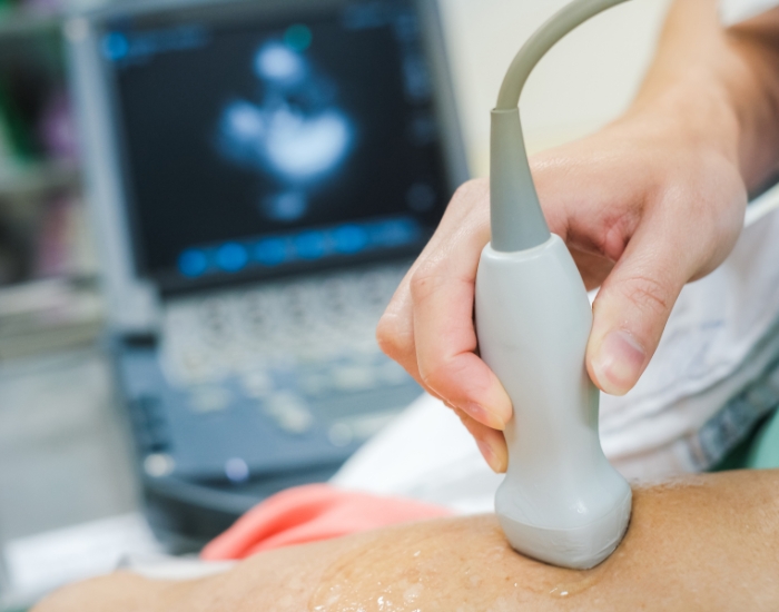 Echocardiogram Test in TX | Apex Heart & Vascular Center